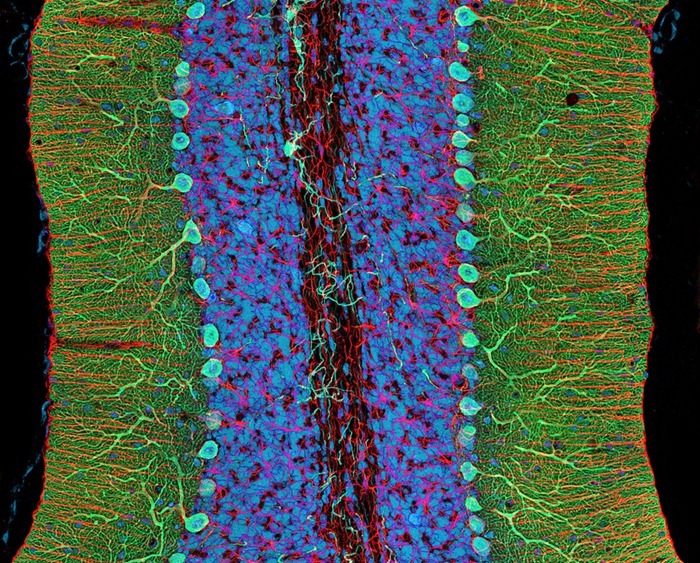 Portraits of the Mind: Brain Cells Under Microscope | Amusing Planet